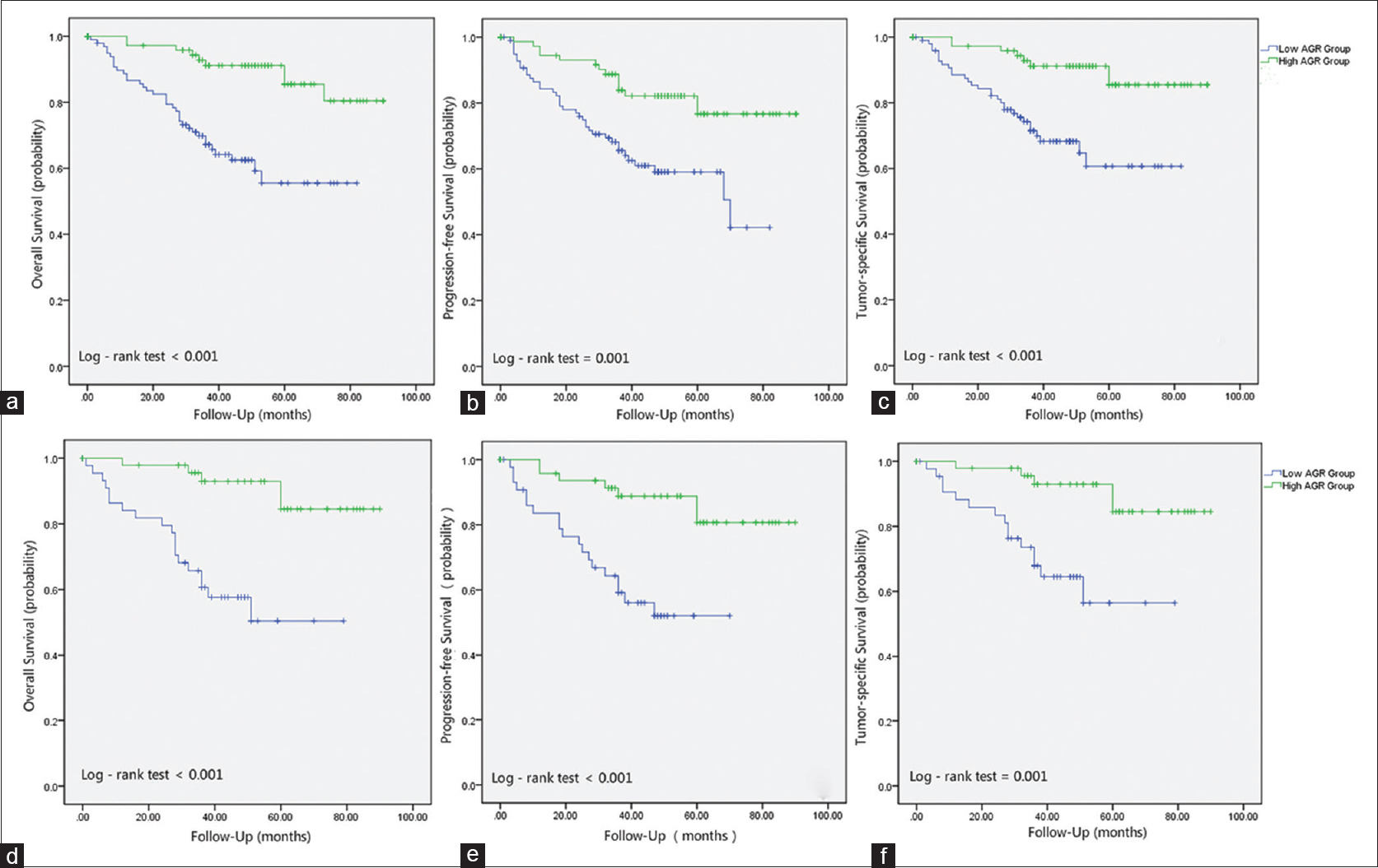 The Prognostic Value Of Preoperative Serum Albumin Globulin Ratio For
